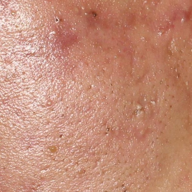 facial-skin-classification Classification Model (v6, 2024-06-05 11:55am ...