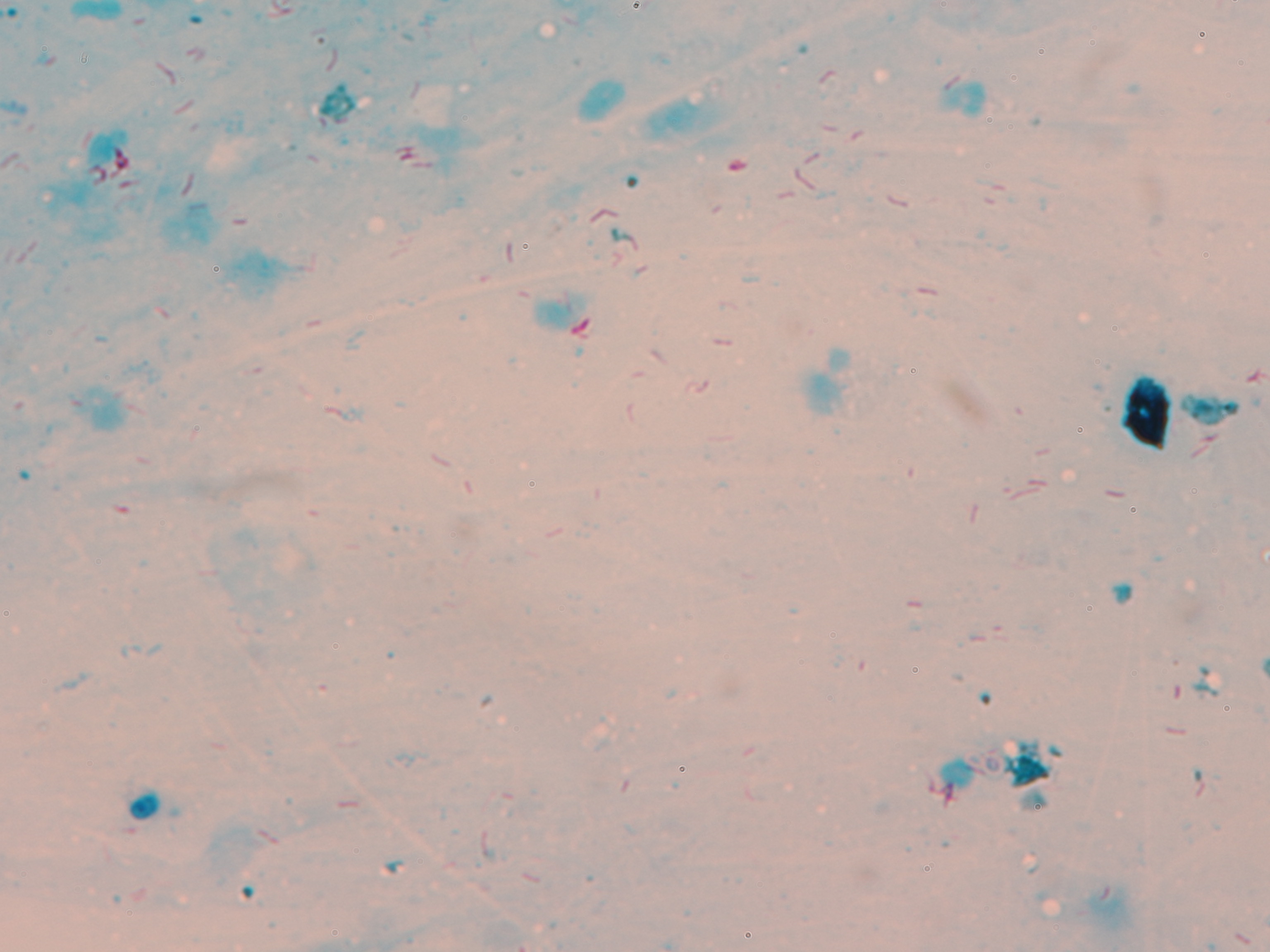 AFB Object Detection Dataset by Harsh