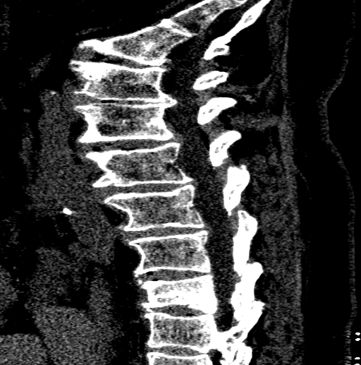 spin Classification Dataset and Pre-Trained Model by myworkspace