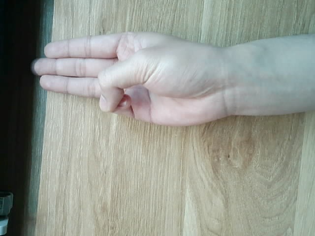 Hand Therapy Exercise v2 Object Detection Dataset by duongdung723