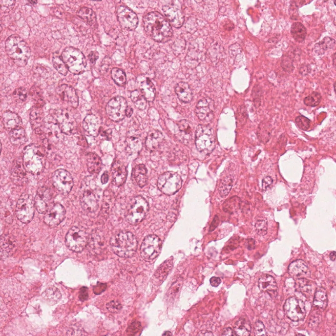 Mitosis Object Detection Dataset By 20029