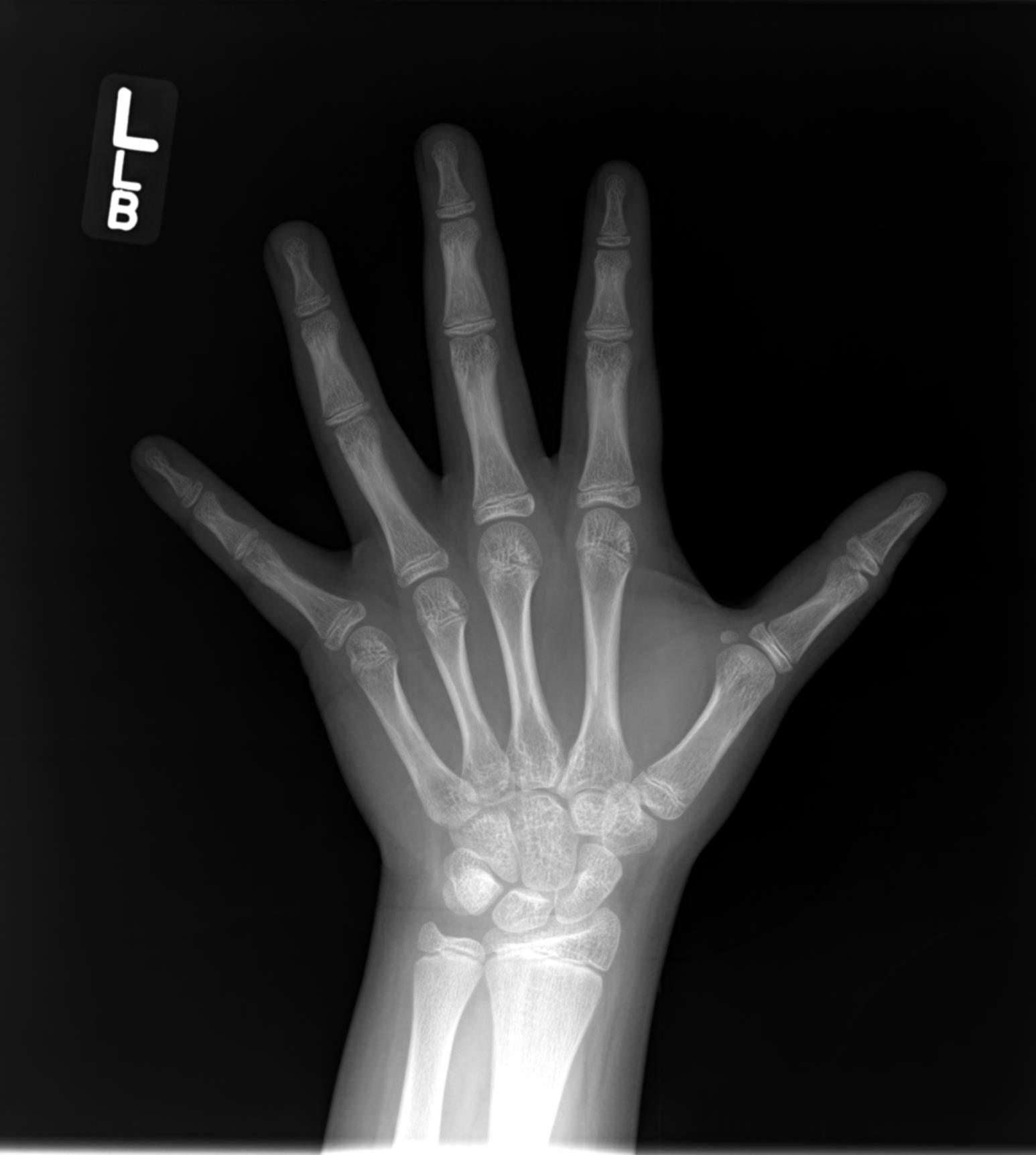 hand_joints_processed Object Detection Dataset by boneage