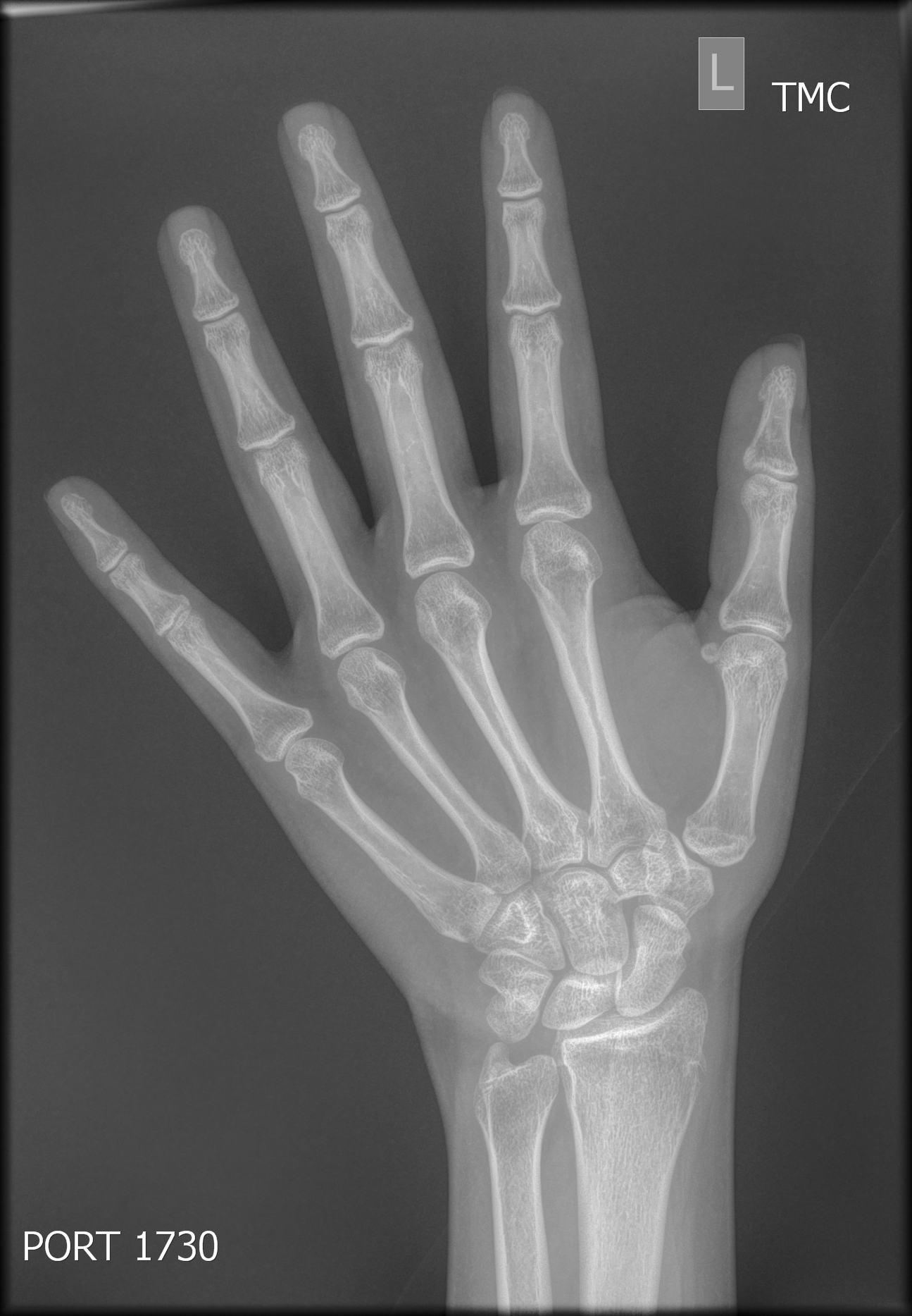 Bone Age Joints Detection Object Detection Dataset By Boneage