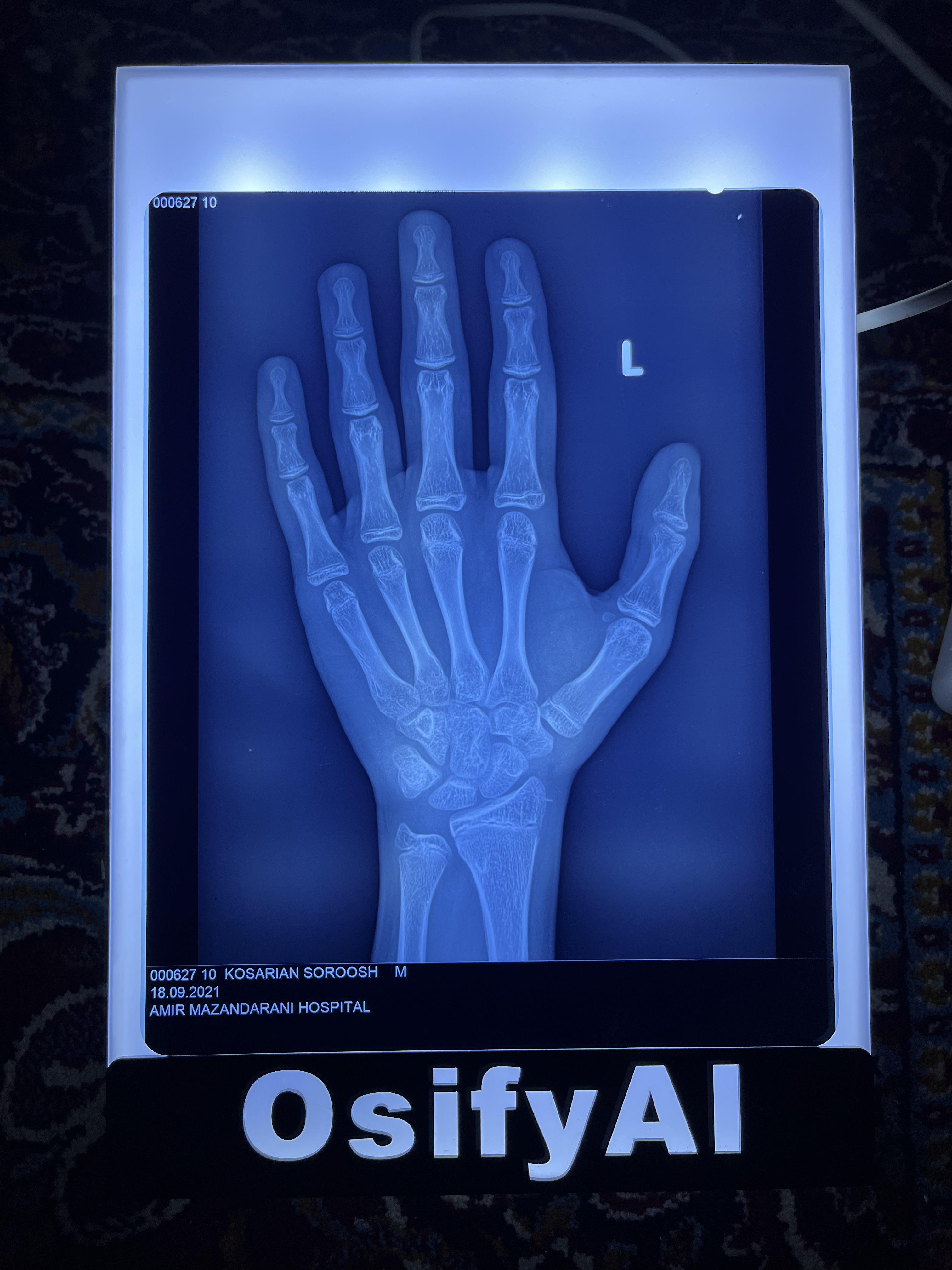 hand_validator Classification Dataset by boneage