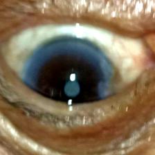 Cataract Annotations Object Detection Dataset by Cataract