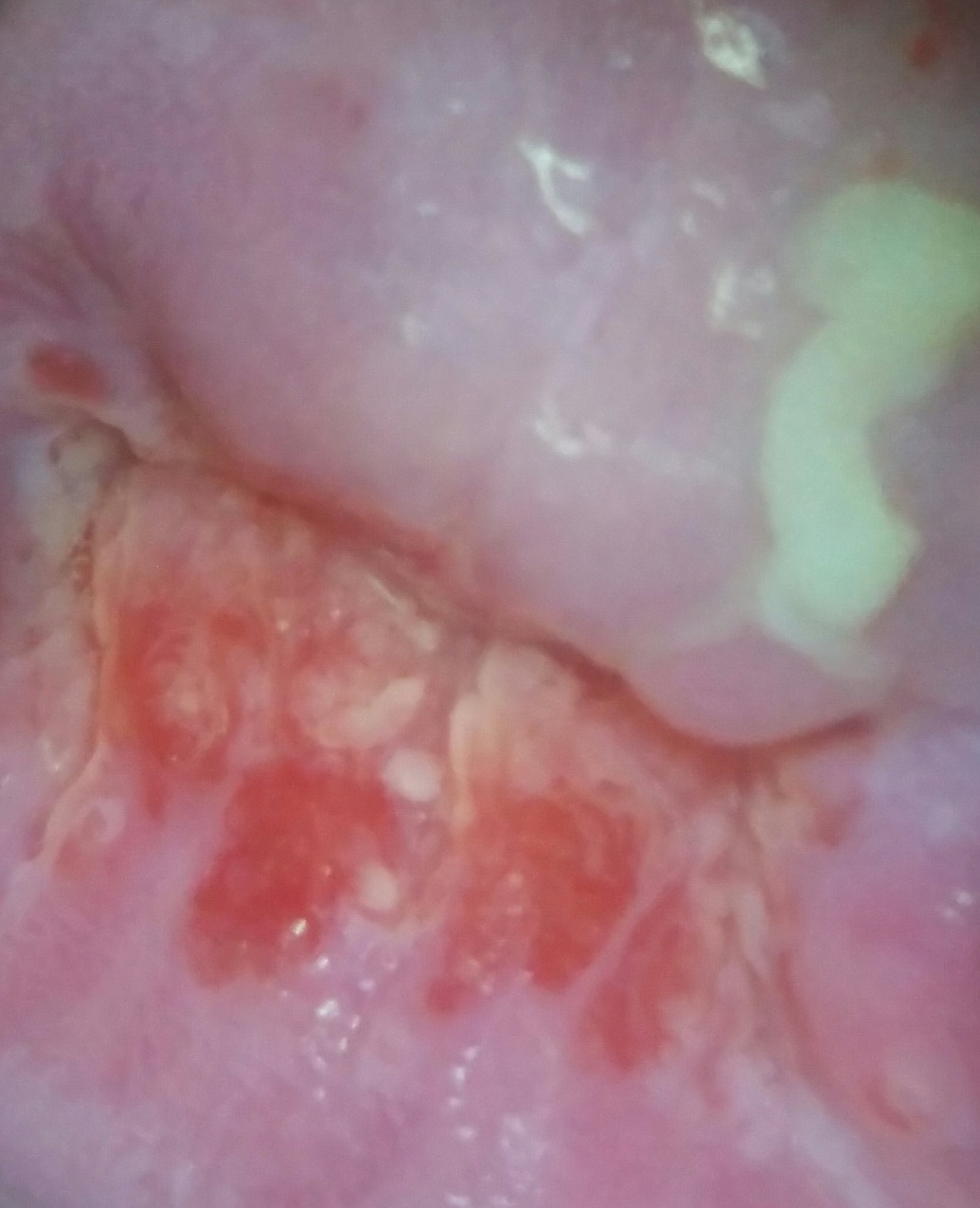 Cervix Object Detection Dataset by Projects