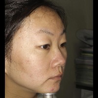 Bluesense (bluesense-dpdsf) - Roboflow Universe