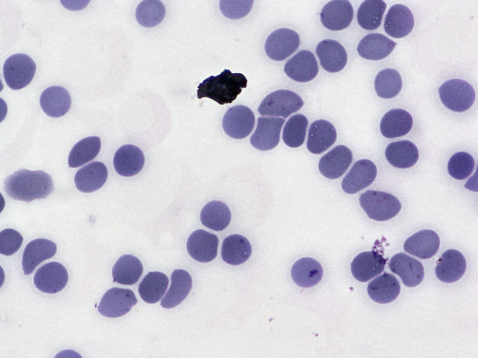 Malaria Detection B Object Detection Model by tccssdmalaria
