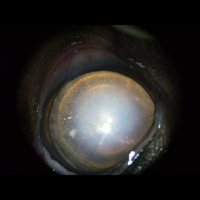 Cataract Object Detection Model by empty