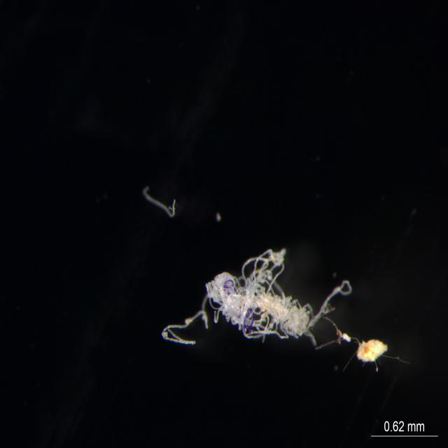 Microplastics Object Detection Model by Altea