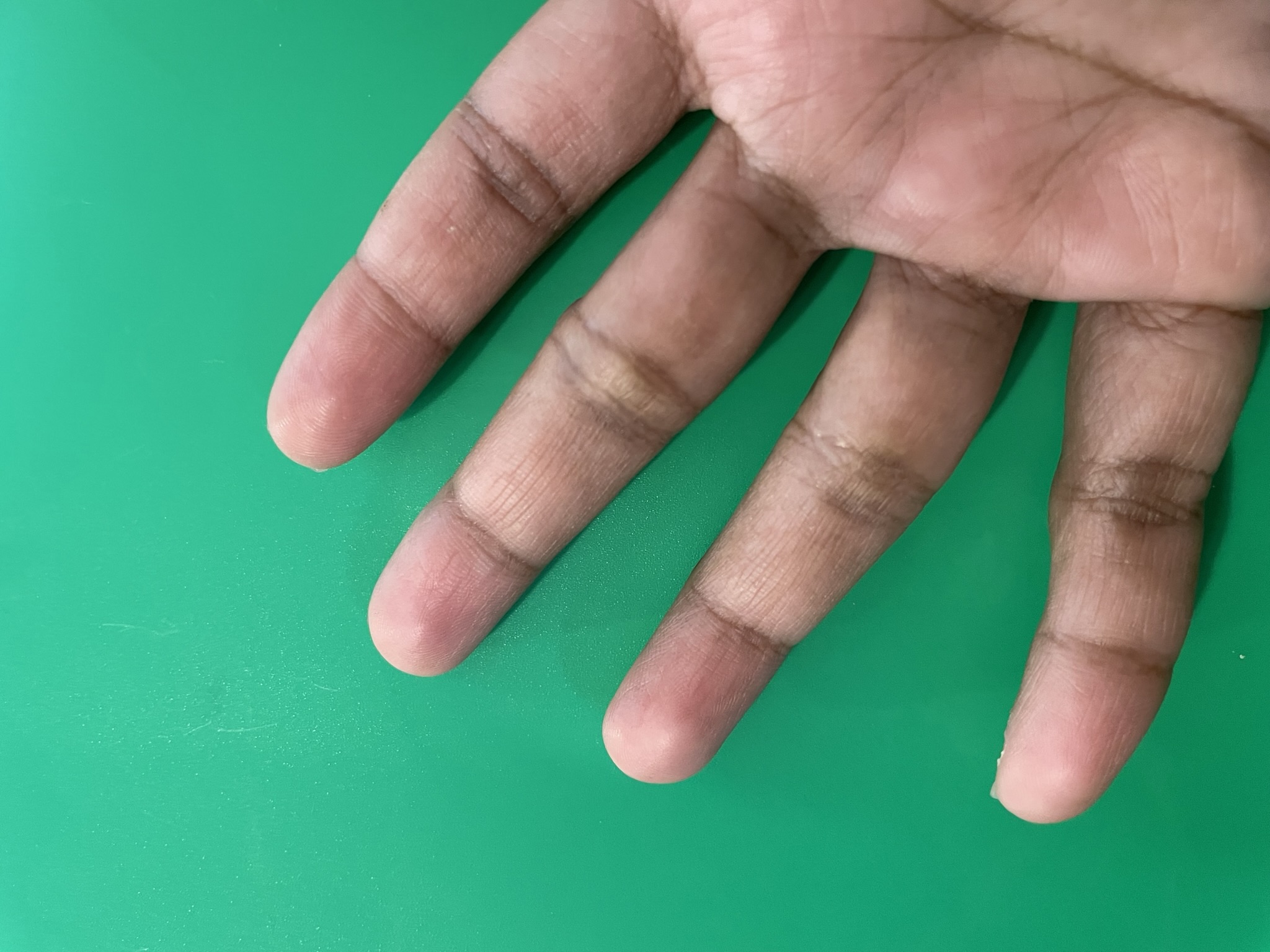 Fingerprint Augmentation Object Detection Dataset by Shawnas Workspace