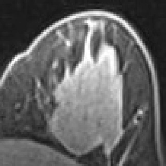 Lesion detect. SB CLASSIFICATION Classification Model by Insper Projeto ...