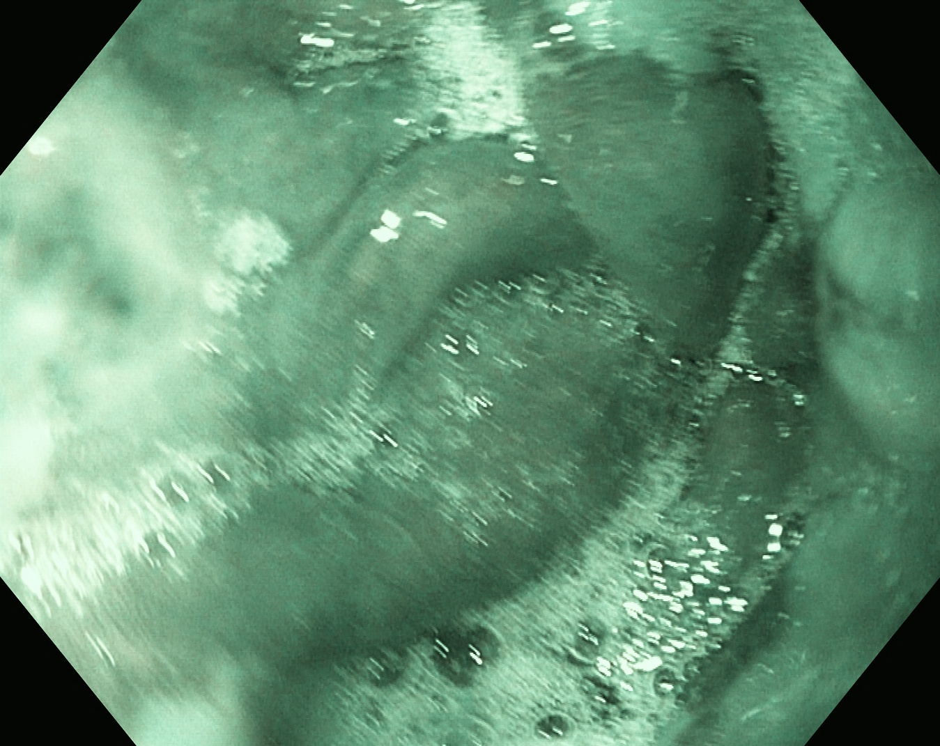 Custom Workflow 6 Single-label Classification Classification Dataset by Janhavi