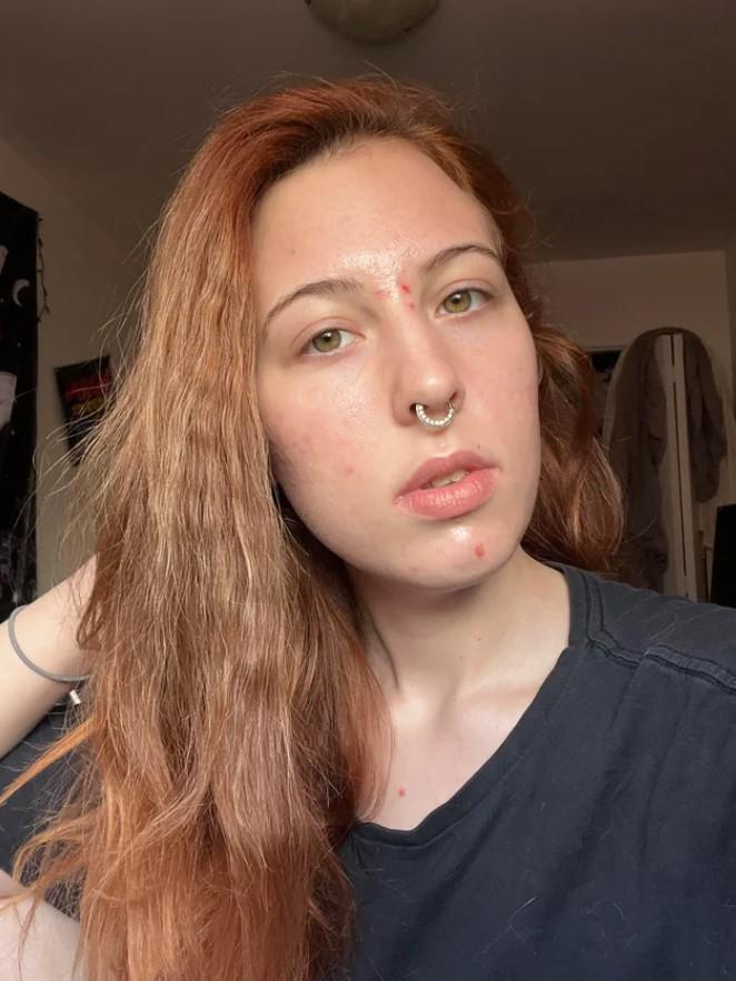 Skin type classification Classification Dataset by faceinc