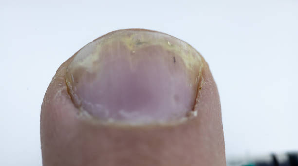 nail-fix Object Detection Dataset by vision