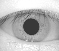 Eye Dedection - Roboflow Universe