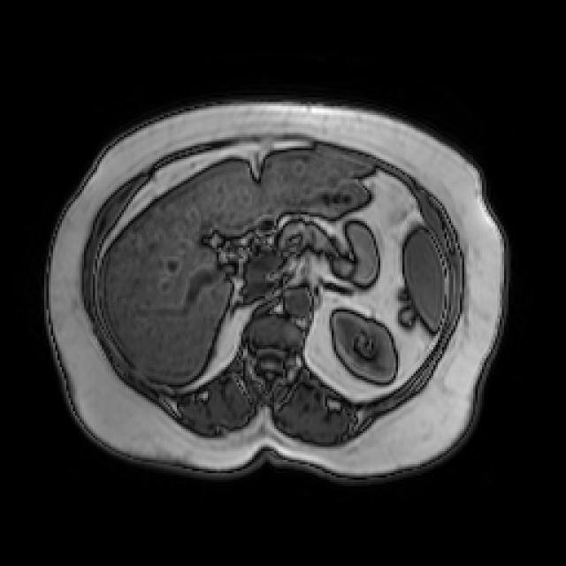 liver Semantic Segmentation Model by tturker