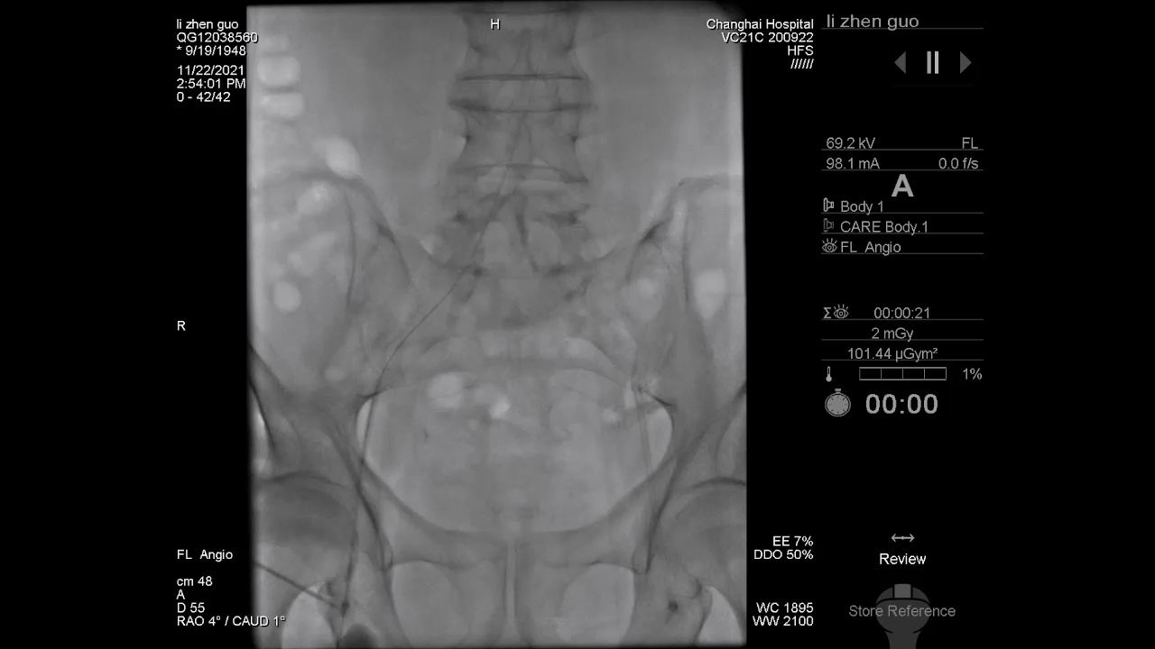 Medical Object Detection Dataset By Xduiestwxf