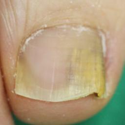 Tim Lauer (tim-lauer-k1awl) - Roboflow Universe