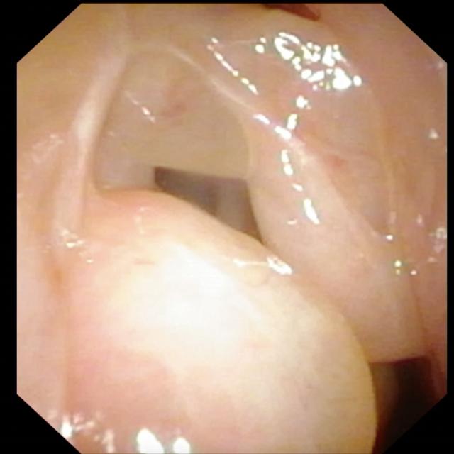 How to Use the instance segmentation Instance Segmentation API