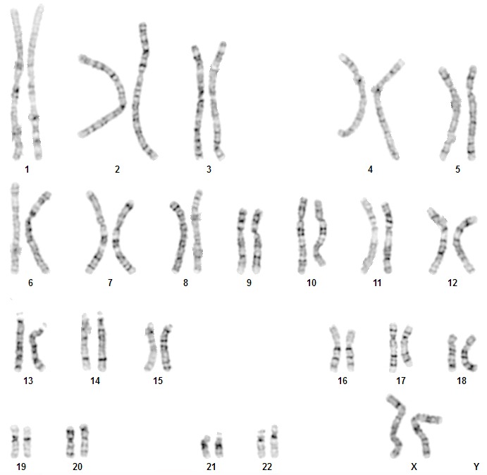 Chromosomes Detection Object Detection Dataset V1 2022 08 28 8 51pm