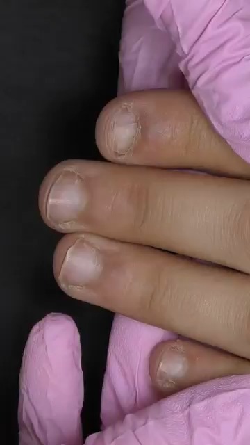 Nail Detection Instance Segmentation Dataset by Nails