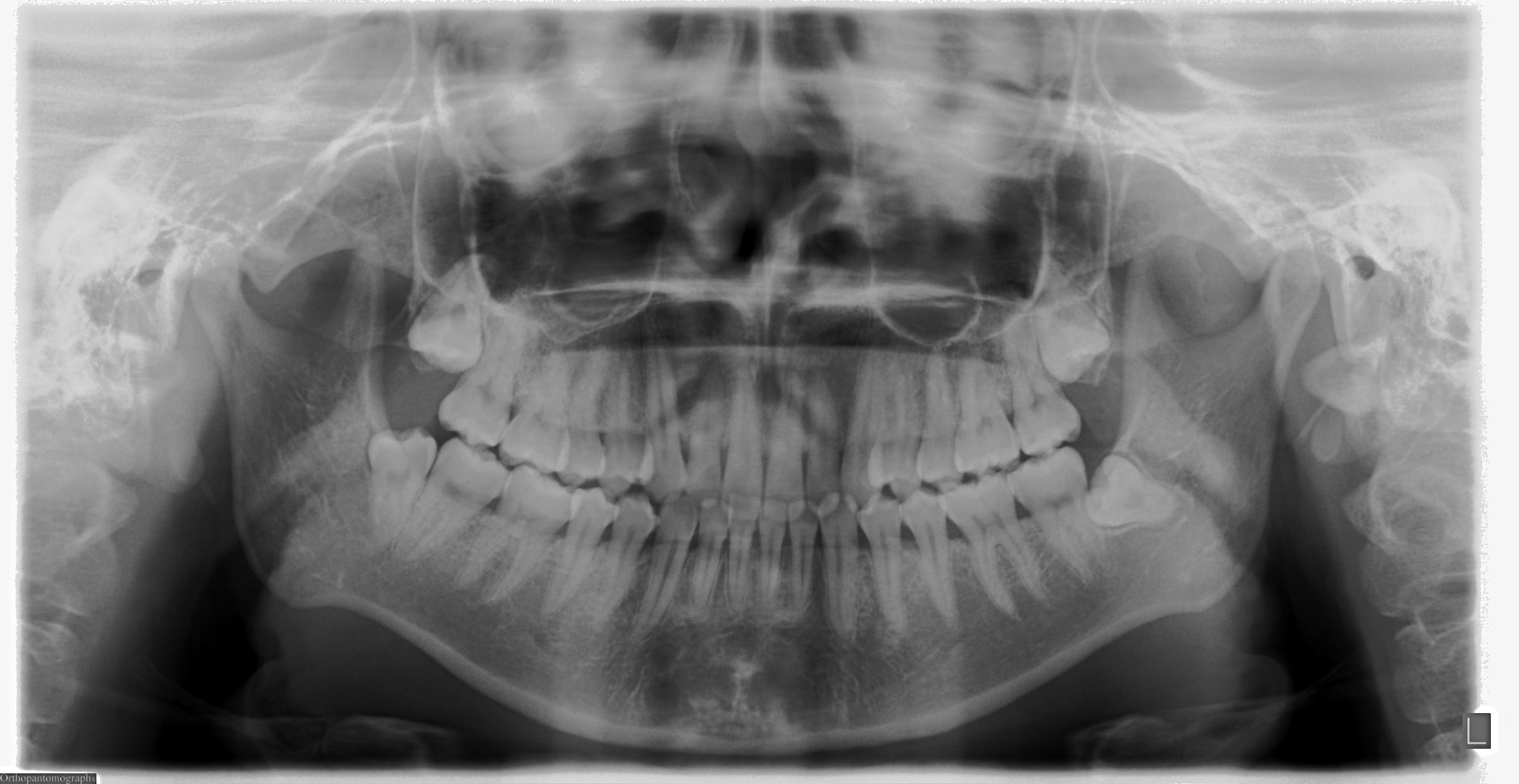 Md Anas (md-anas-wwi89) - Roboflow Universe