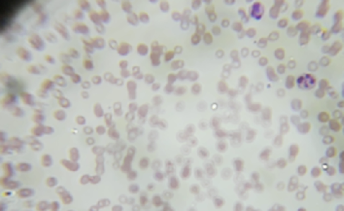 Neuracle Technologies Pvt Ltd - Roboflow Universe