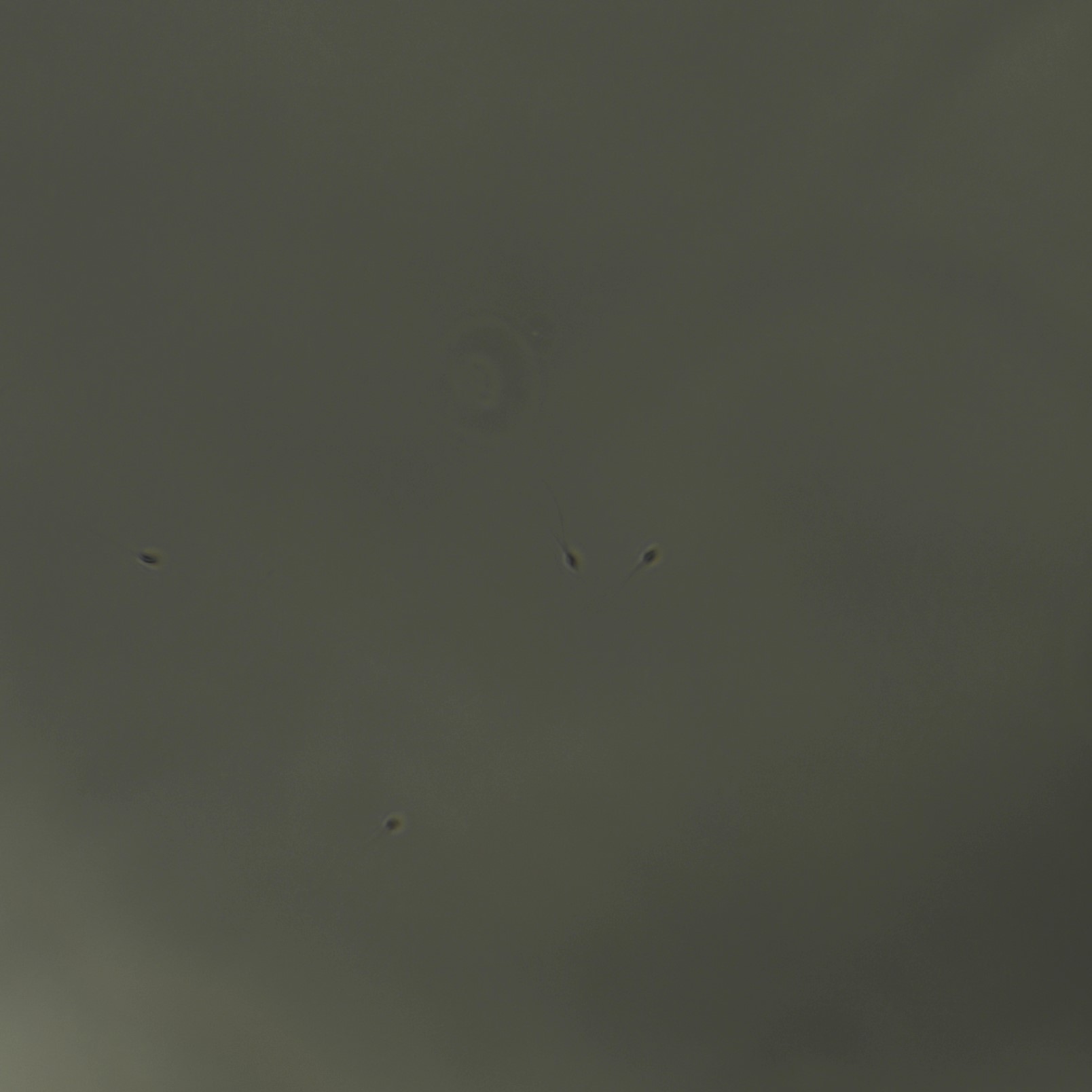 sperm tracking Object Detection Dataset by dongwon kim