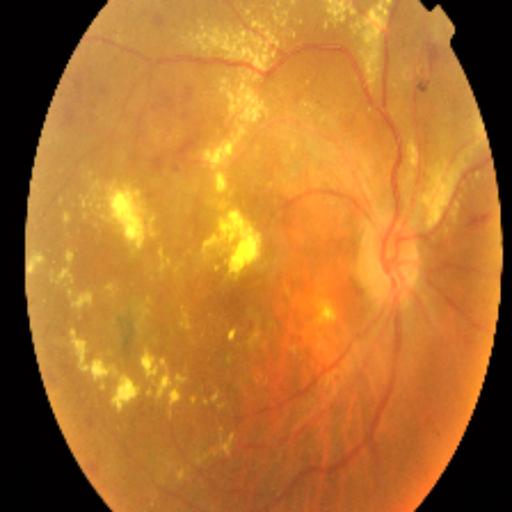 Final Year Project FYP (final-year-project-fyp-qpwem) - Roboflow Universe