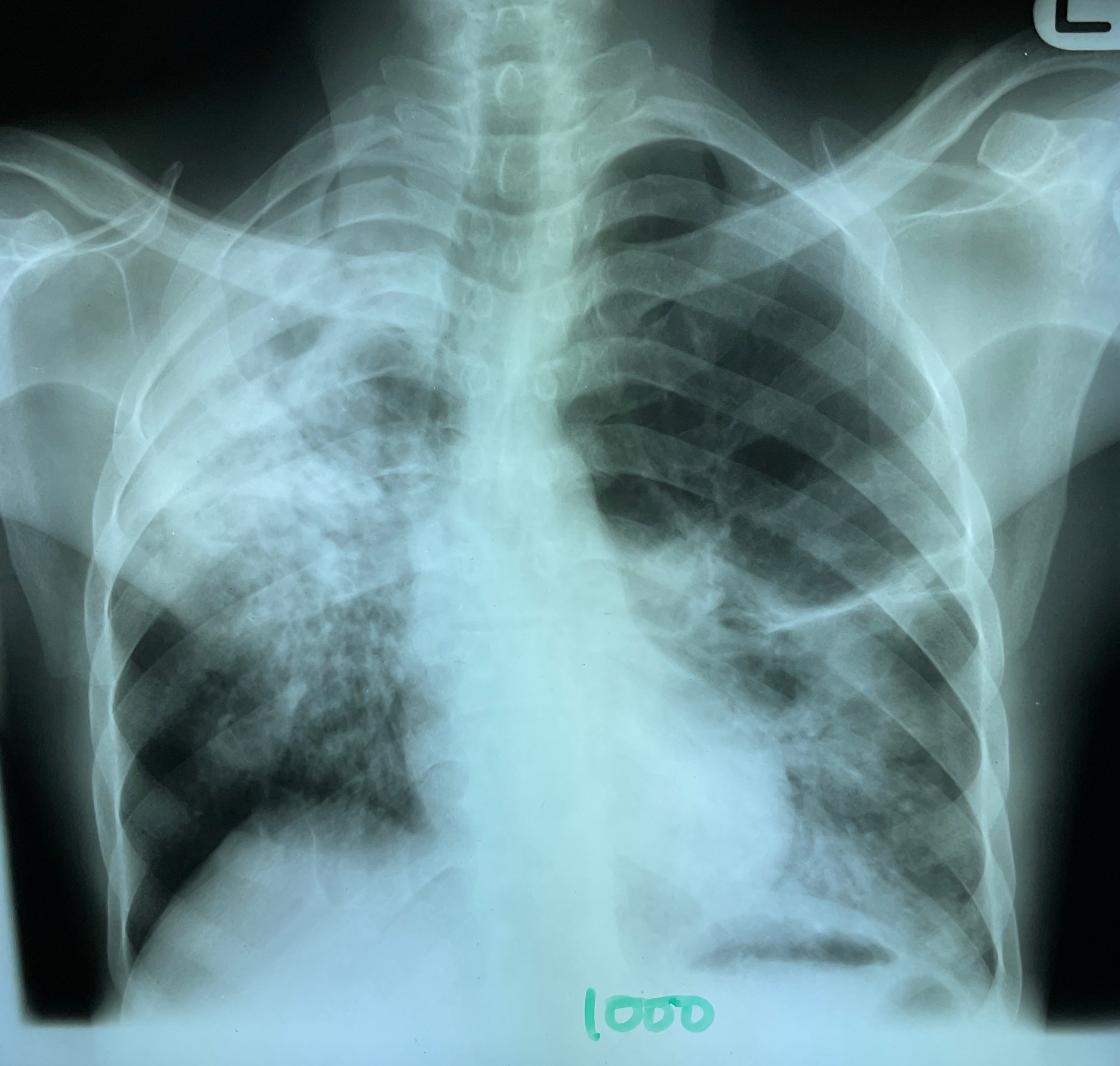 ew Instance Segmentation Model (v5, 2024-12-02 3:59pm) by Projects