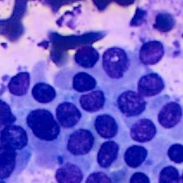 Screw Detection Object Detection Dataset By Practicas