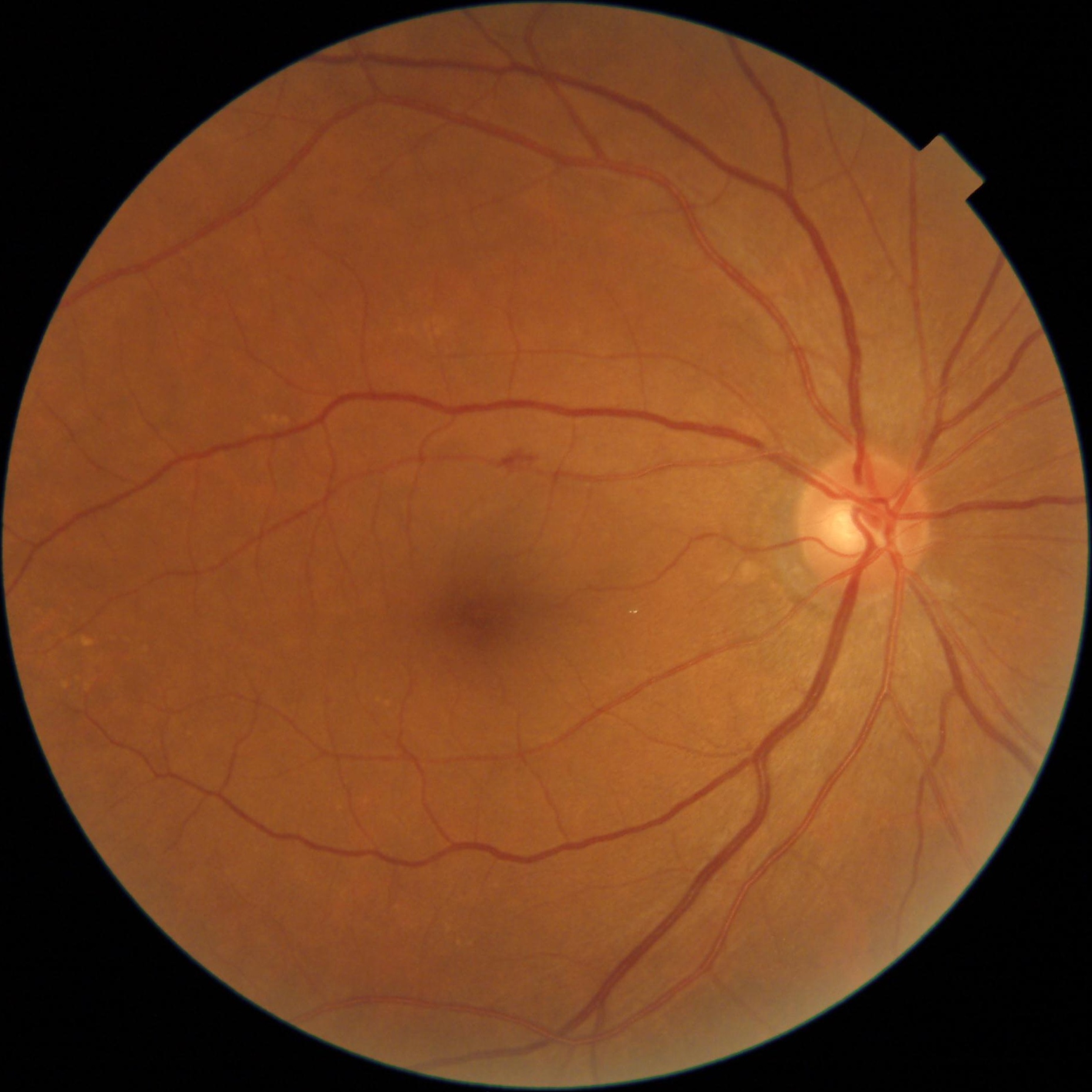 Resize Retina Object Detection Model by Proyecto retina