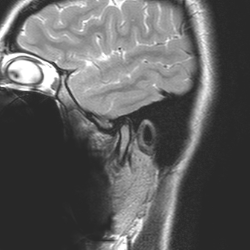 mrt vnchs Instance Segmentation Dataset and Pre-Trained Model by vnchs