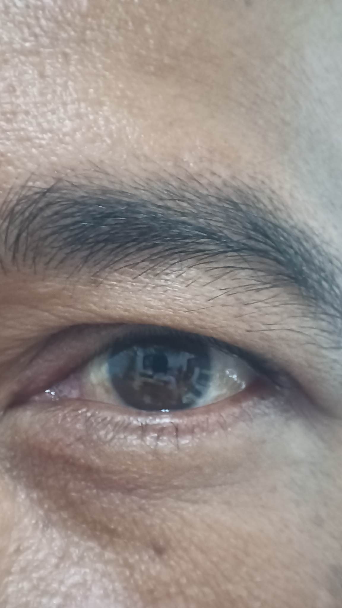 Iris Instance Segmentation Model by airanaaaan