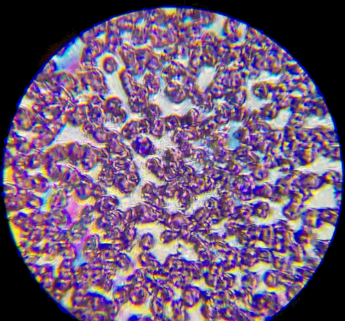 blood_cell Object Detection Model by bloodcell