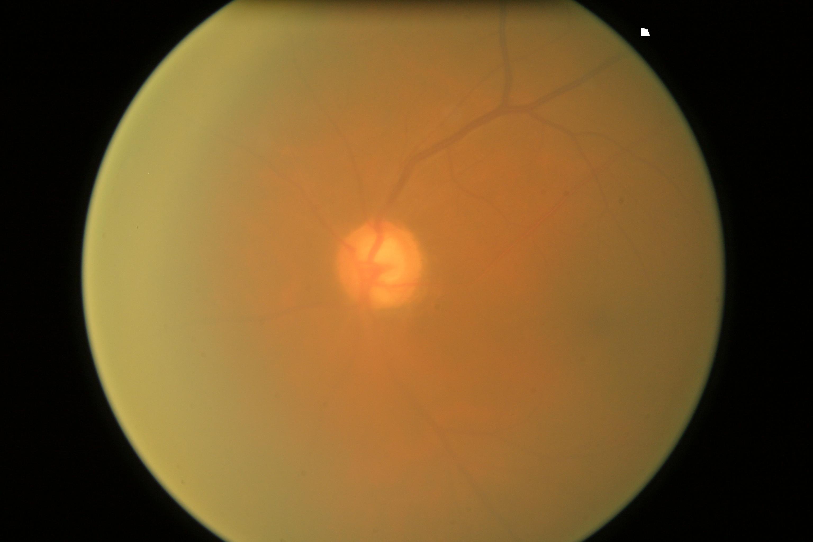 Capstone Project DICODING Semantic Segmentation Dataset by tasyas