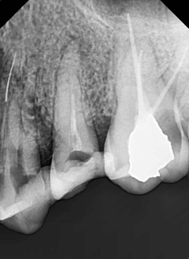 New Dent Computer Vision Dataset By Dent Dataset