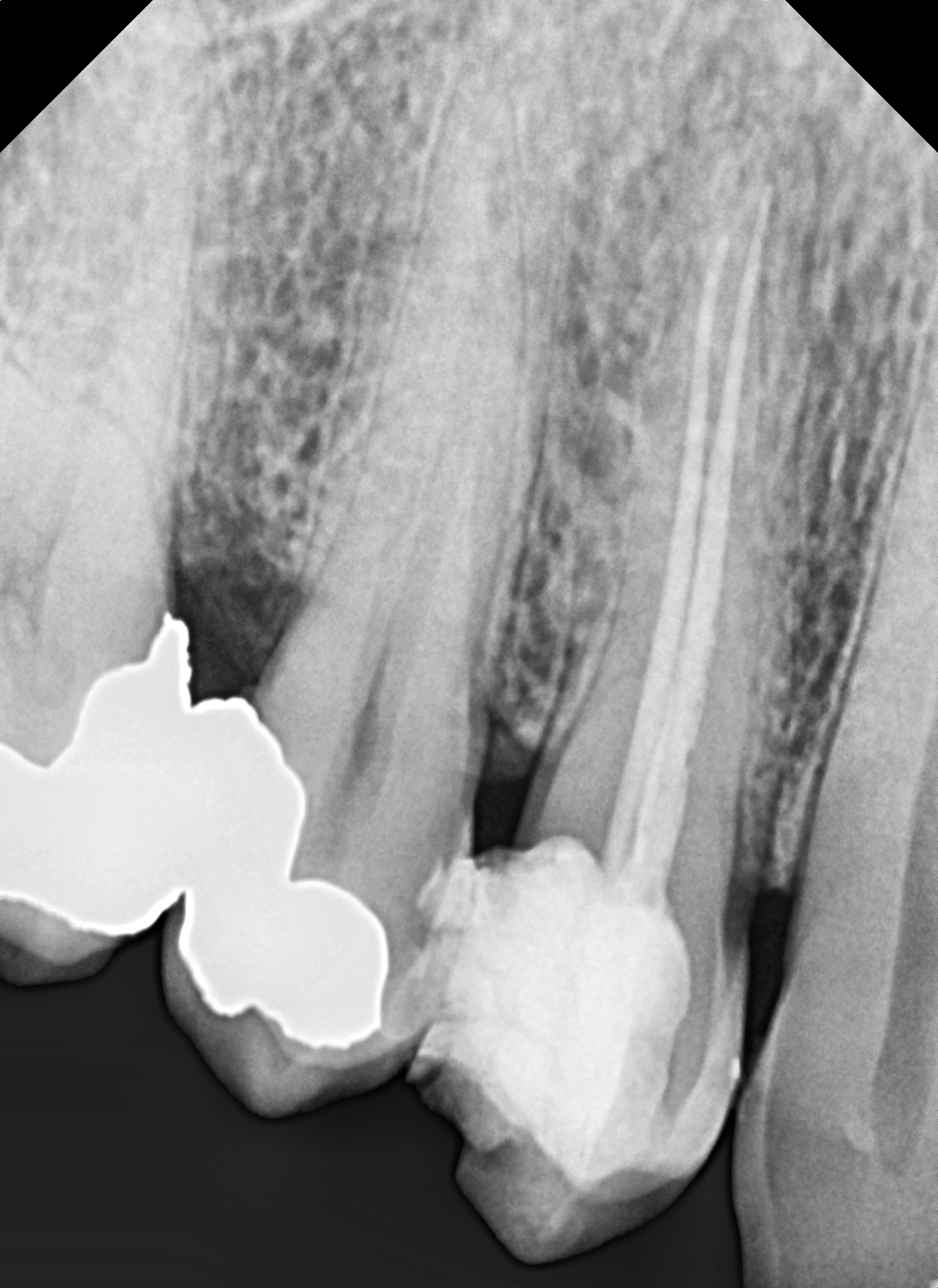 one for testing something YOLO maximizing 2 Object Detection Dataset ...