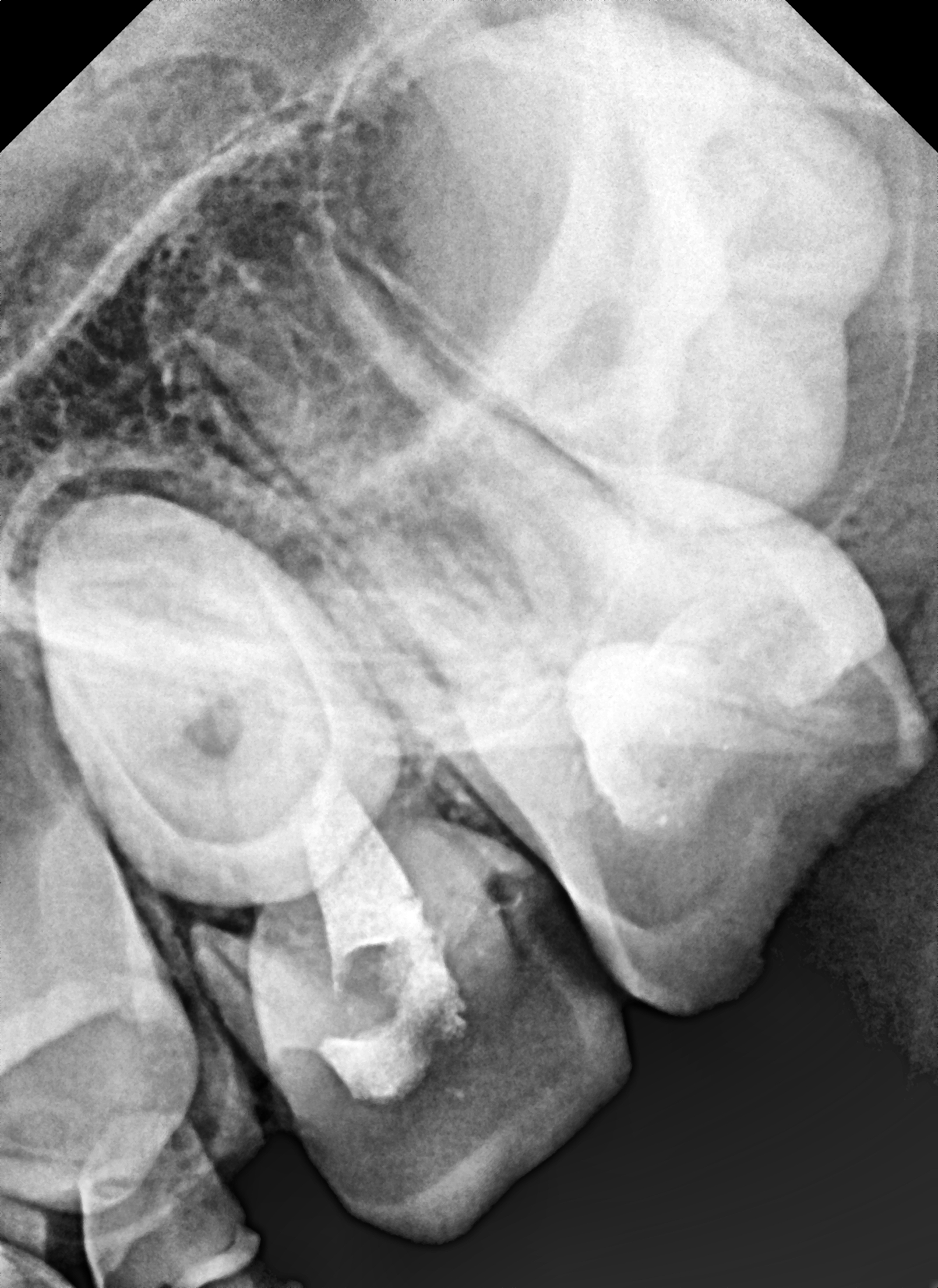 Dental Annotation Object Detection Dataset And Pre Trained Model By