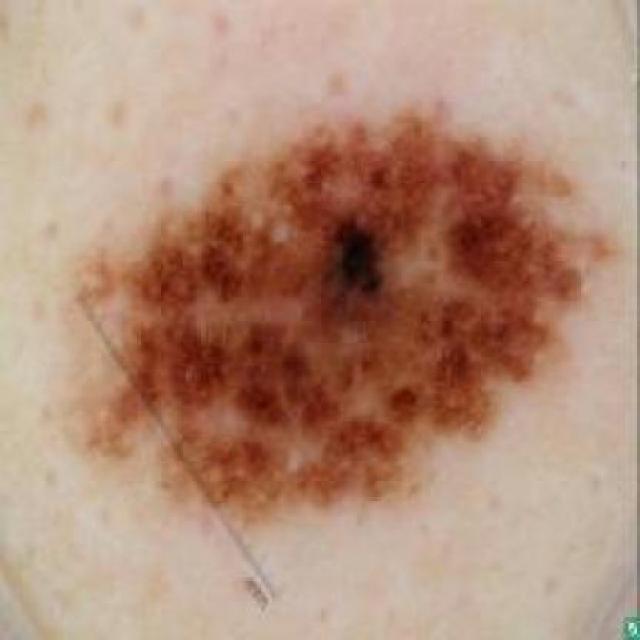 medical-image-classification-model Classification Model by ucla