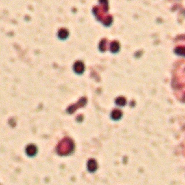 Bacteria Detection Object Detection Dataset V4 2025 04 03 11 37am By Hit