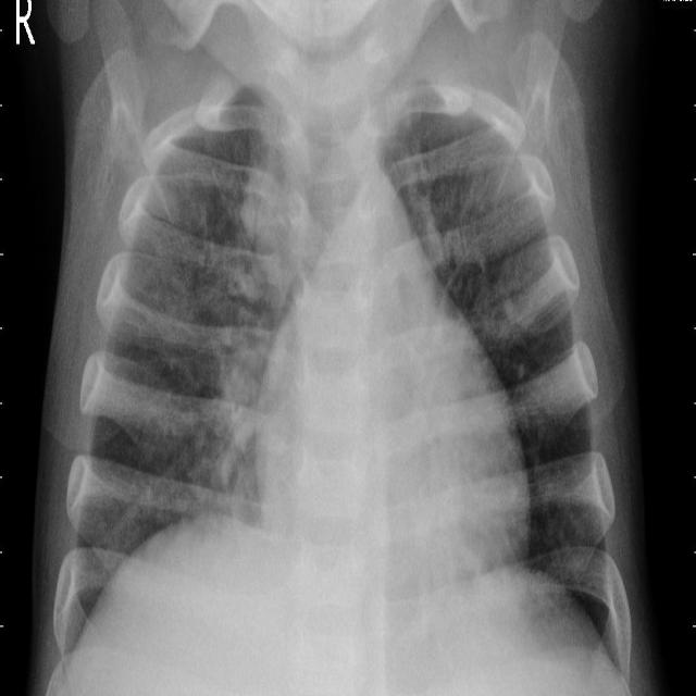 Carlos Treinamento - Roboflow Universe