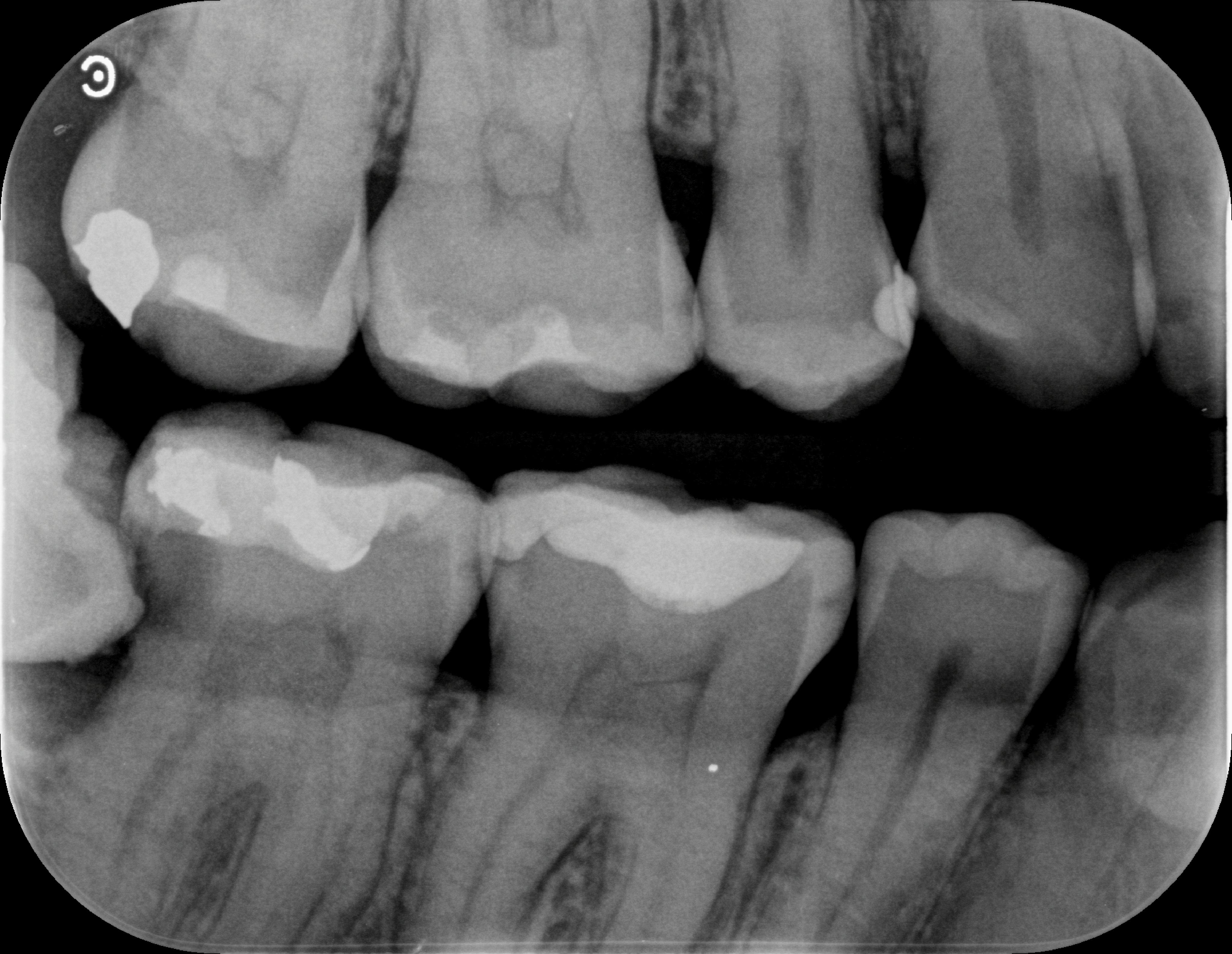 ia (ia-gcvqp) - Roboflow Universe