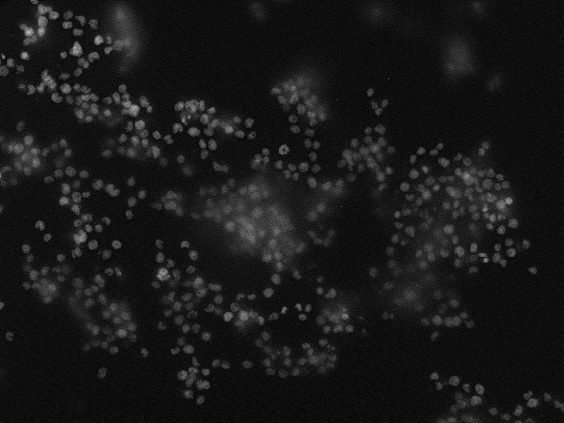 Cell COunting Object Detection Dataset by Project