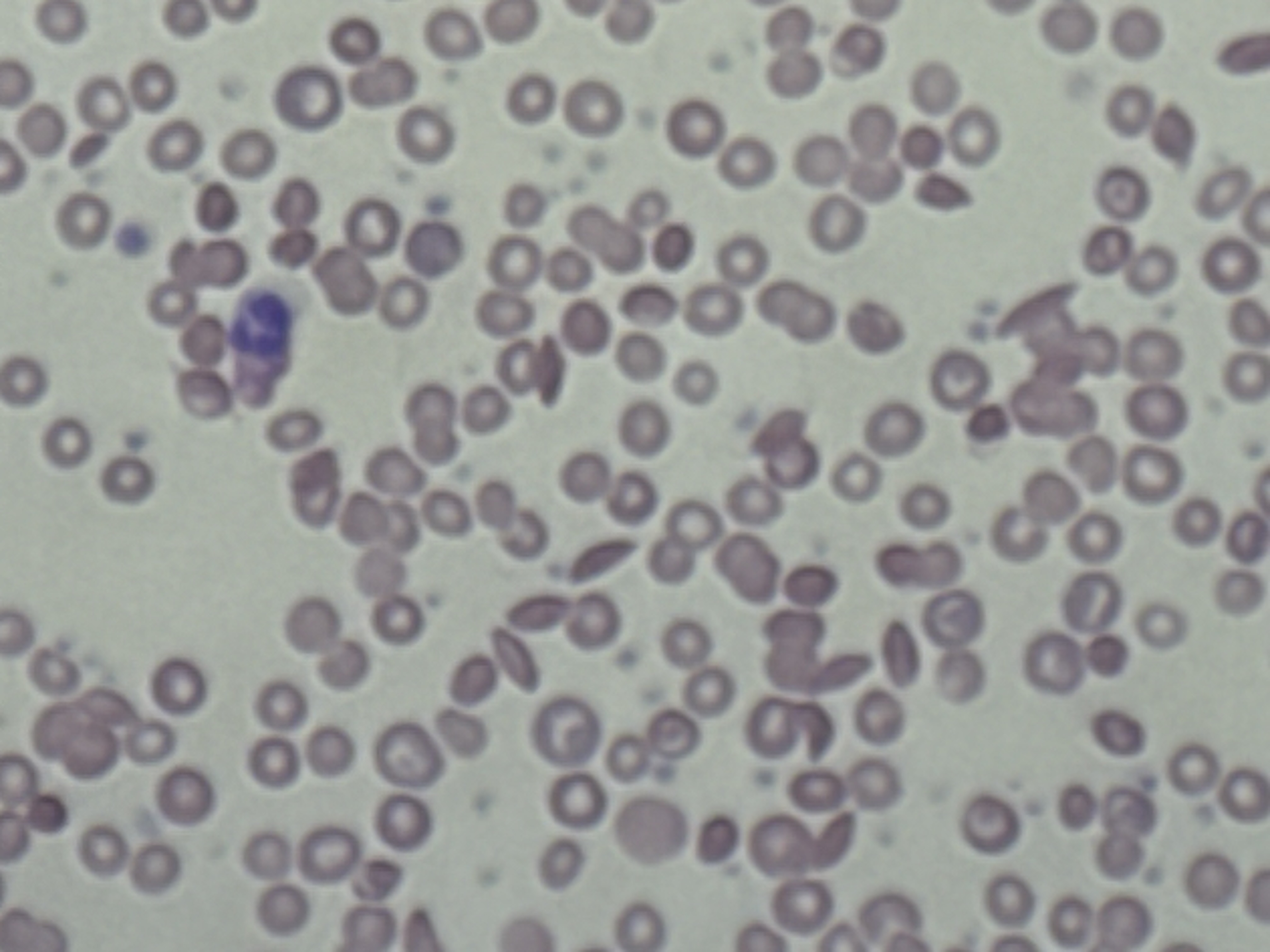 red-blood-cells Object Detection Dataset by Detect Cells