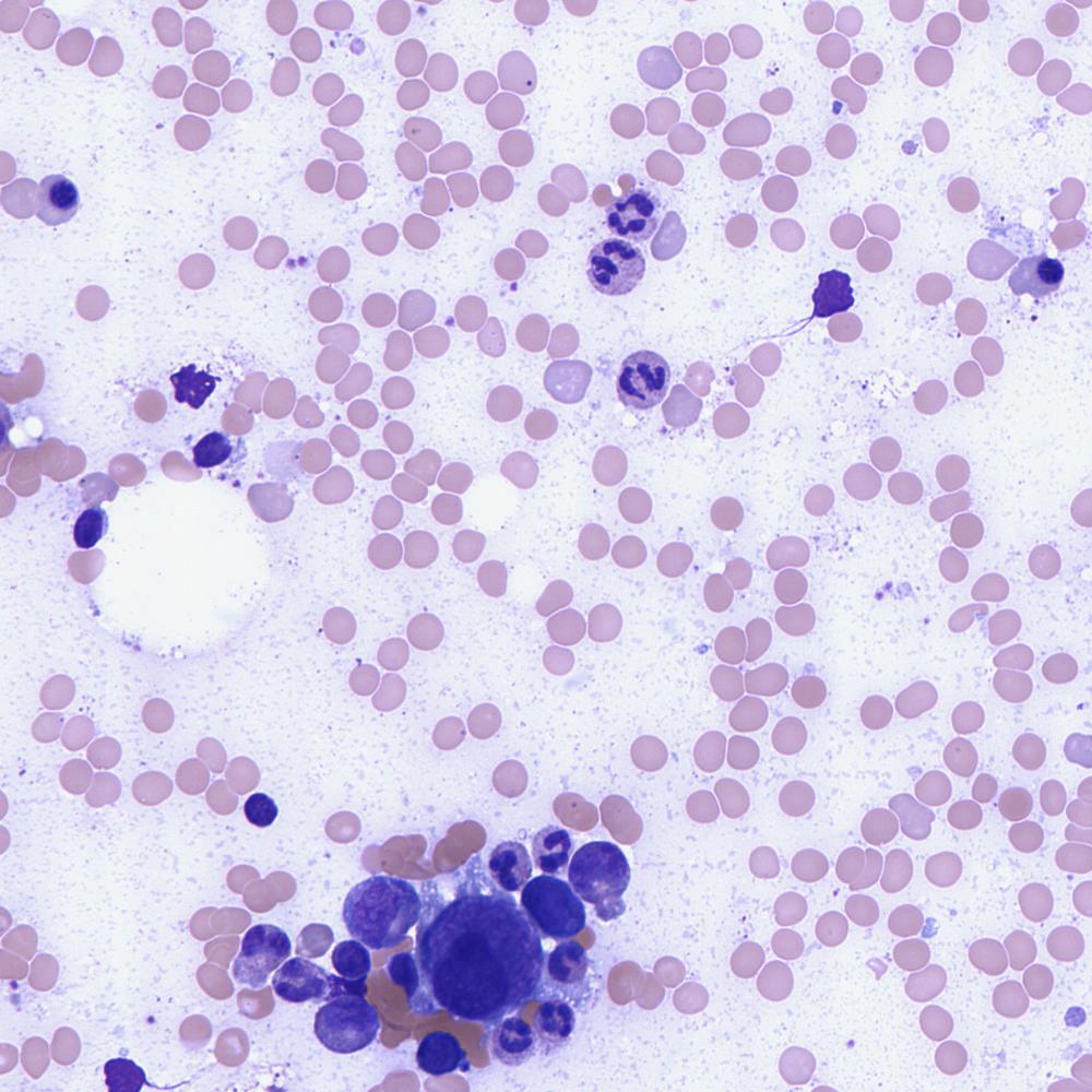 Cancer Cell Detect Object Detection Model By Detect Cells