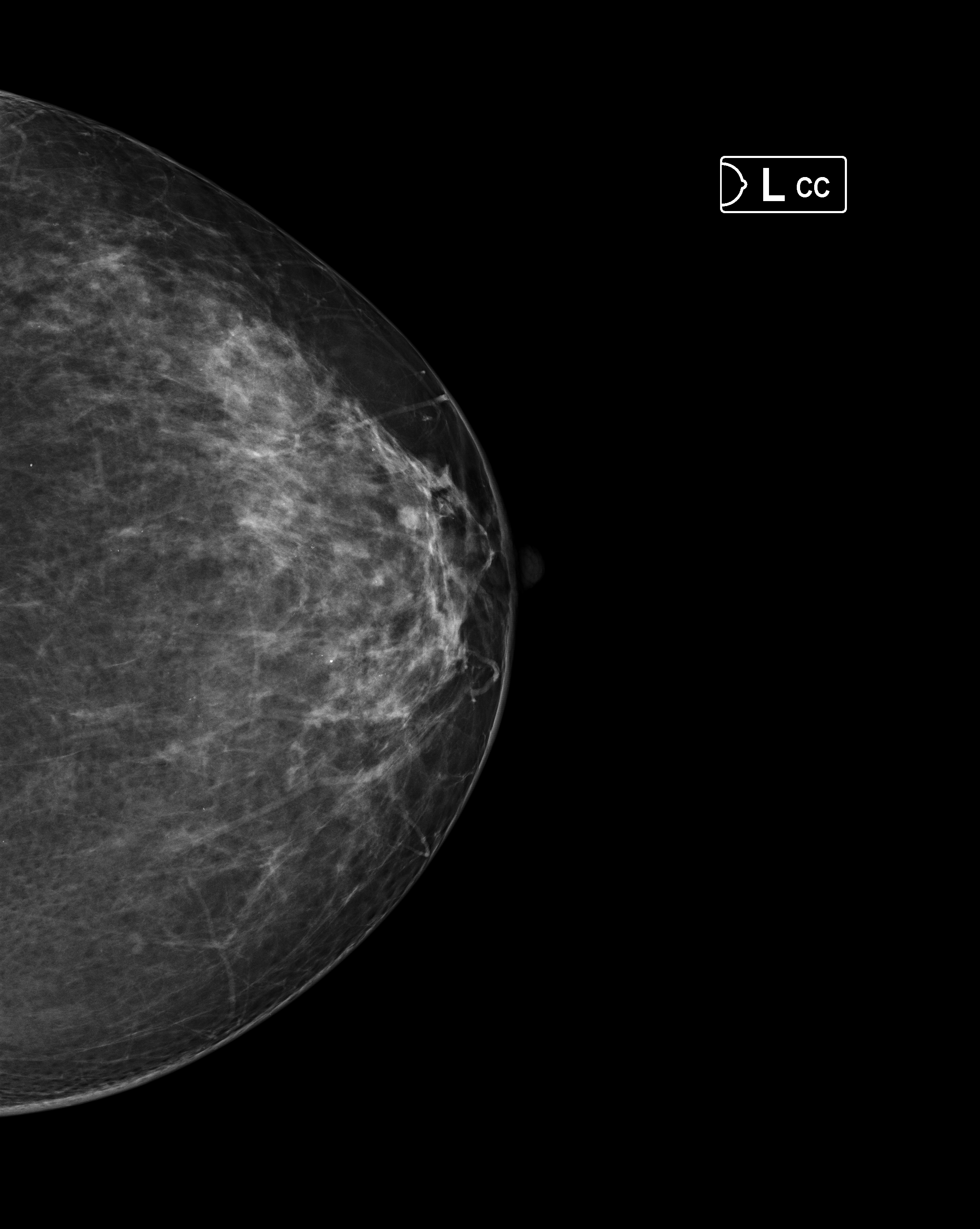 Leonardo Iheme Leo (leonardo-iheme-leo-5s2bo) - Roboflow Universe