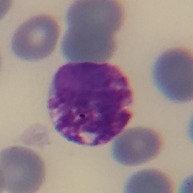 MAIN DATASET Object Detection Dataset by Blood Cell Count