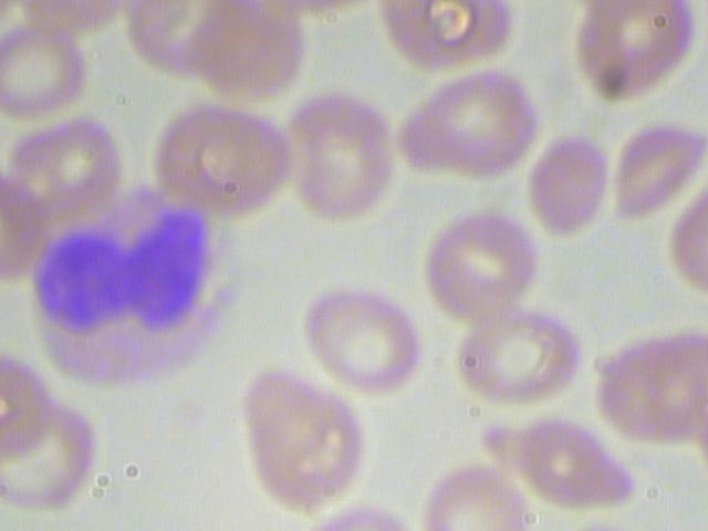 Blood Cell Test Object Detection Dataset by Testing